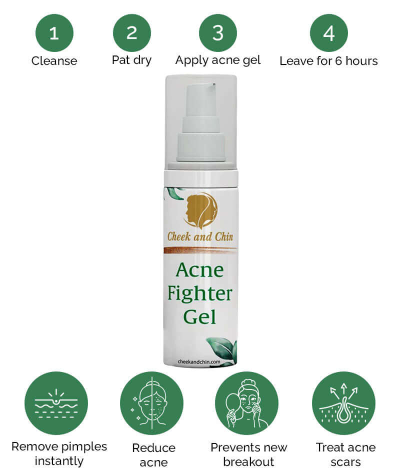 Acne Fighter Gel – Cheek and Chin